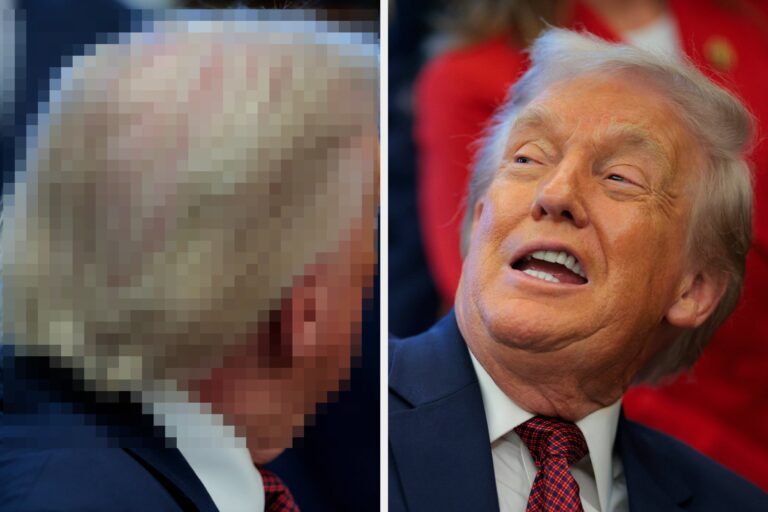 Viral Photo Highlights Donald Trump's Thinning Hair Amid Health Updates ...